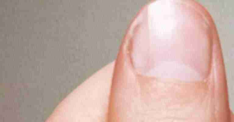 La lúnula es un indicador importantísimo de tu salud, te contamos lo ...