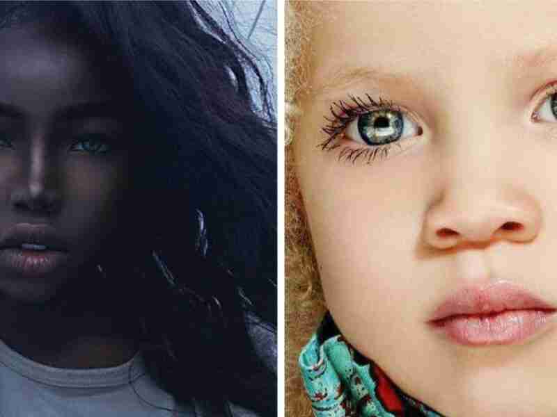 Las 10+ personas con los colores de piel más sorprendentes del planeta…