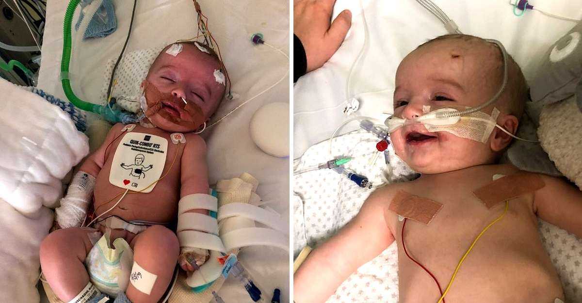 Bebé sorprende a los médicos tras despertar de un coma de 5 días. Lo ...