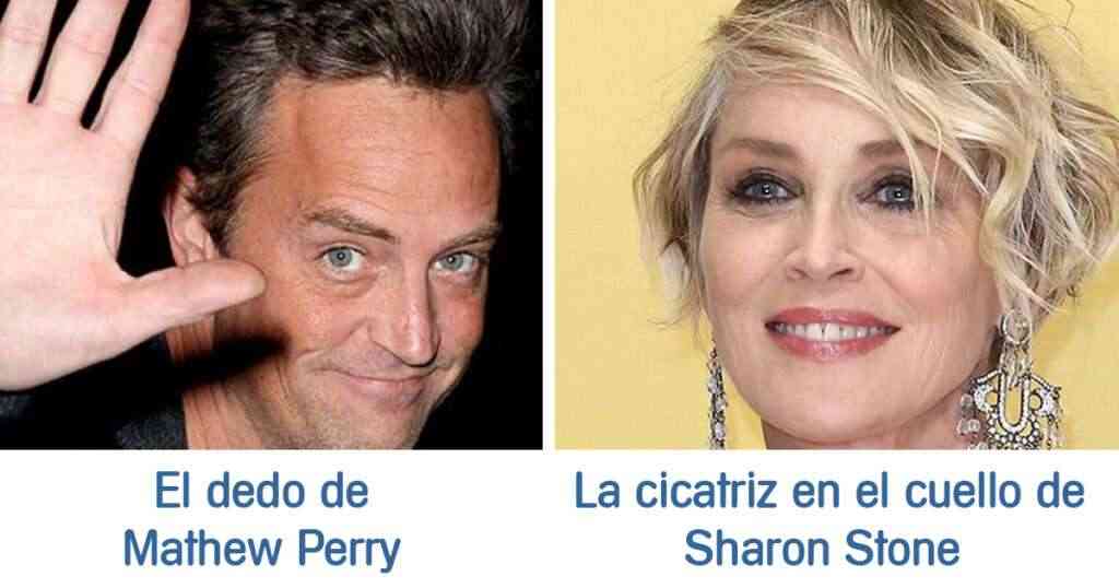 9 «defectos» físicos en personas famosas de los que no te habías ...